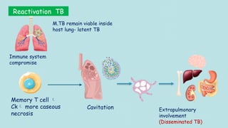 Pulmonary Tuberculosis, Integrated teaching Dr Naila.pptx