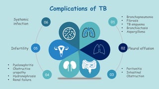 Pulmonary Tuberculosis, Integrated teaching Dr Naila.pptx