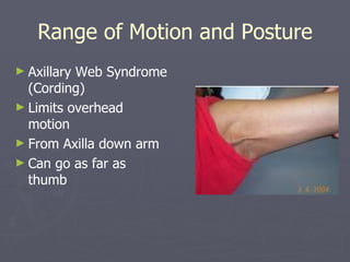 Physical Therapy: A Component of the Cancer Care Plan | PPT