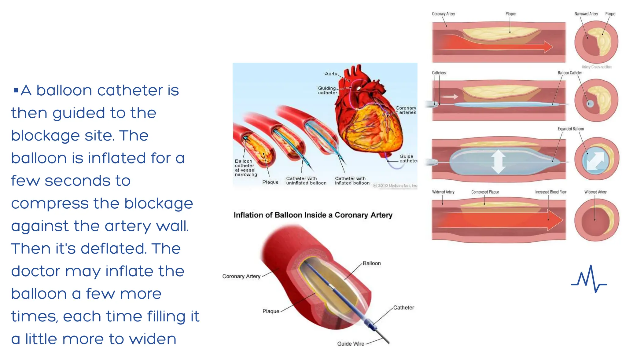 Percutaneous transluminal coronary angioplasty (PTCA) and coronary artery bypass graft (CABG) | PPTX