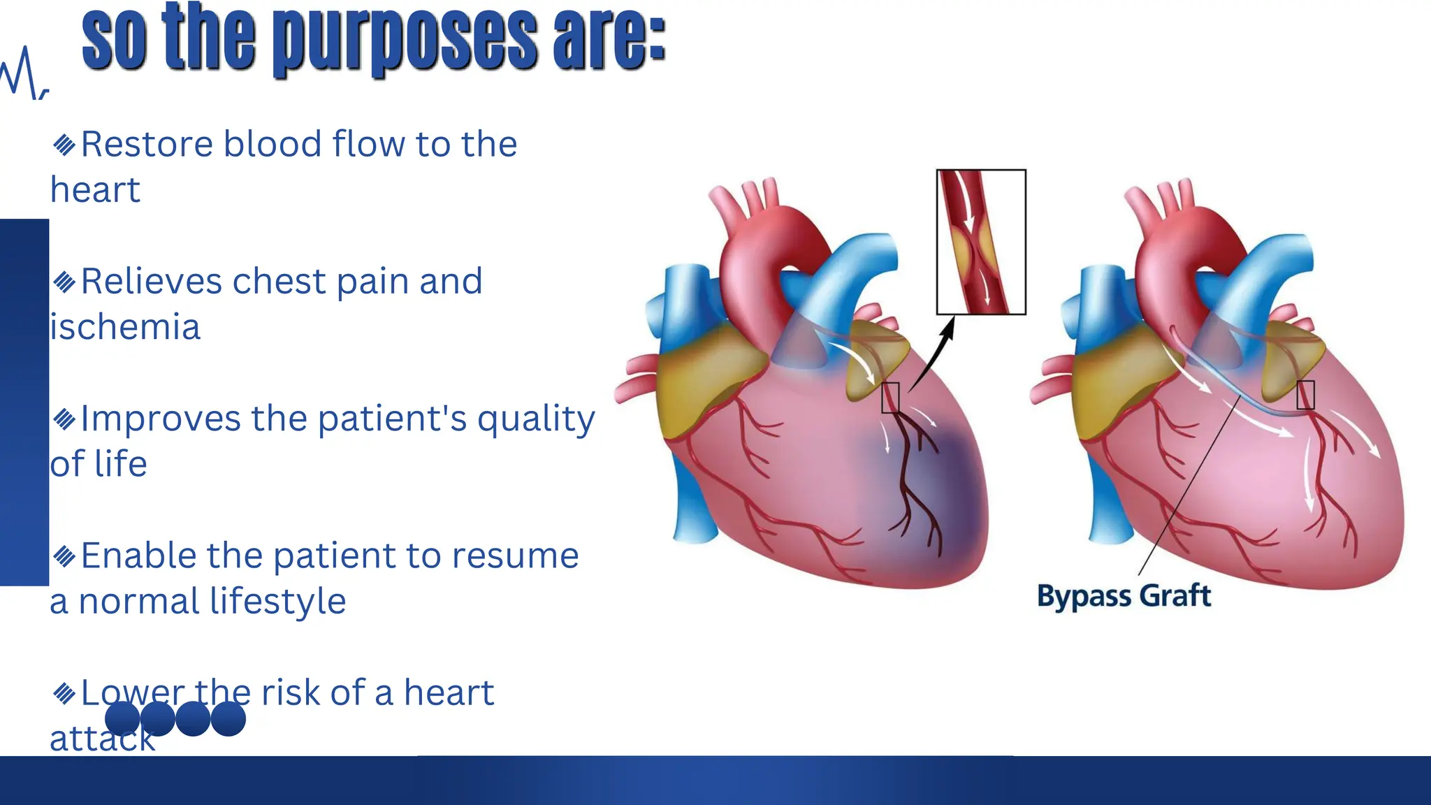 Percutaneous transluminal coronary angioplasty (PTCA) and coronary ...