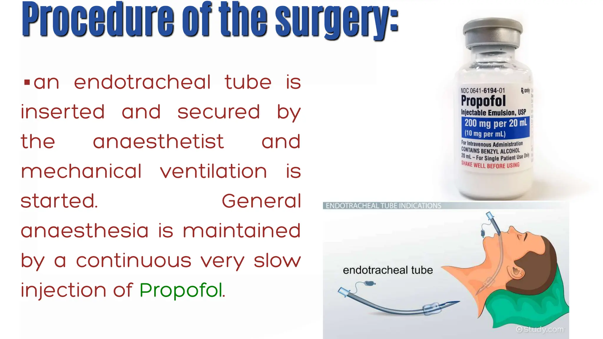 Percutaneous transluminal coronary angioplasty (PTCA) and coronary ...