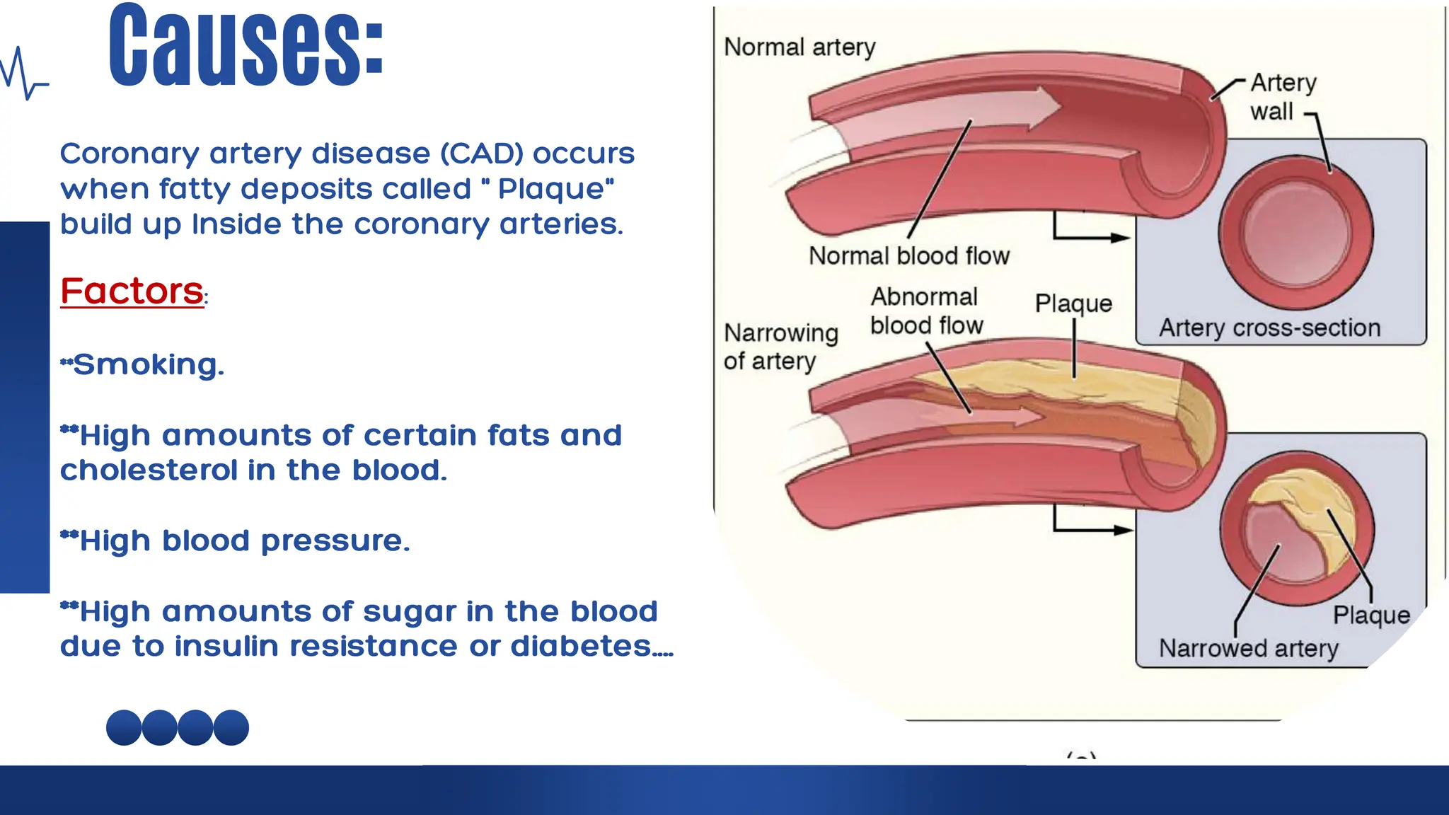 Percutaneous transluminal coronary angioplasty (PTCA) and coronary artery bypass graft (CABG) | PPTX