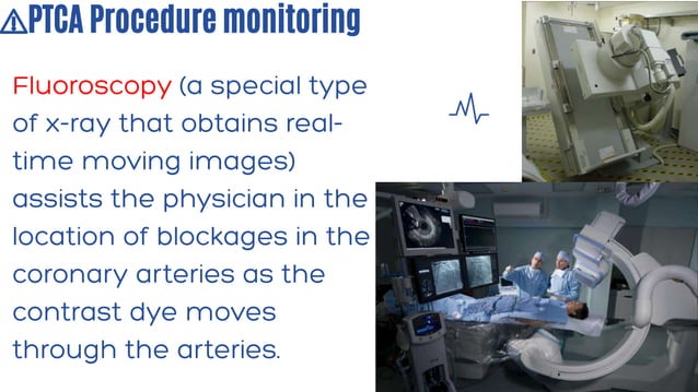Percutaneous transluminal coronary angioplasty (PTCA) and coronary ...