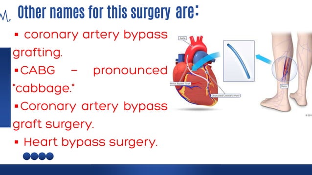 Percutaneous transluminal coronary angioplasty (PTCA) and coronary ...