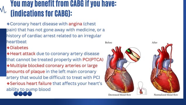 Percutaneous transluminal coronary angioplasty (PTCA) and coronary ...