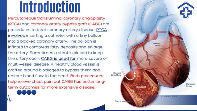 Percutaneous transluminal coronary angioplasty (PTCA) and coronary ...