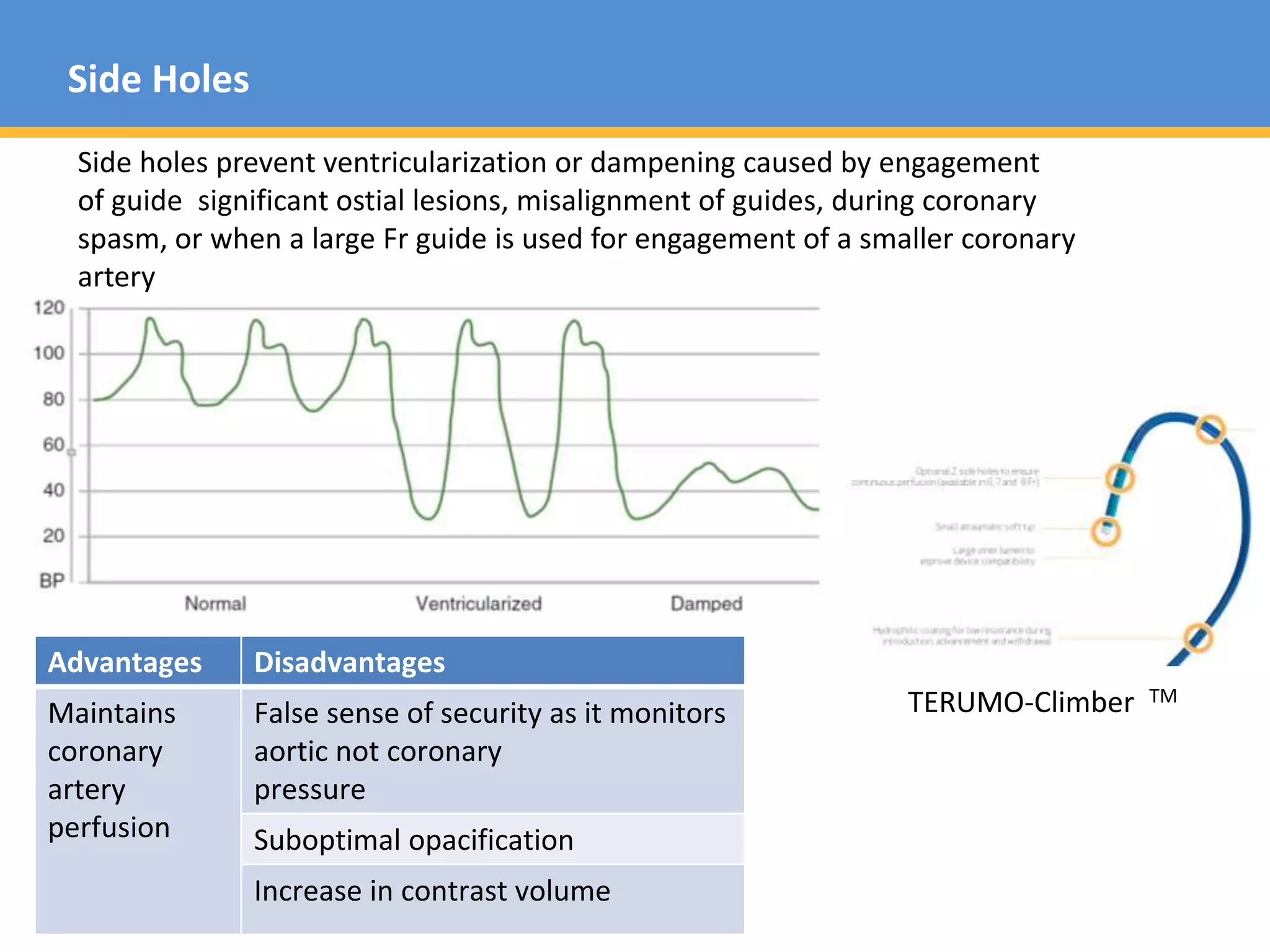 Catheters used in Angiography & angioplasty | PPTX