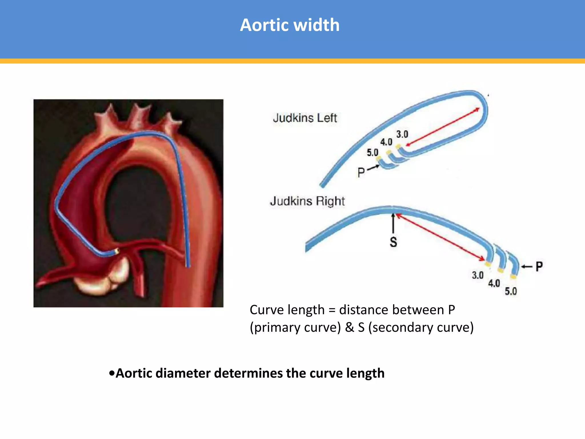 Catheters used in Angiography & angioplasty | PPTX