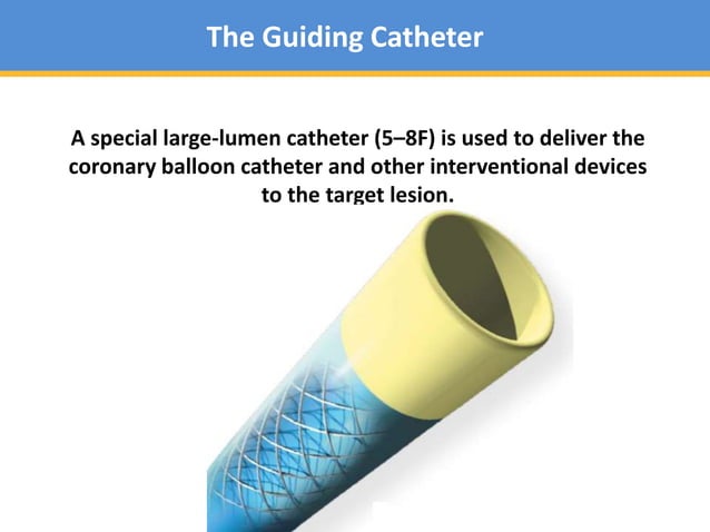 Catheters used in Angiography & angioplasty | PPTX | Heart and ...