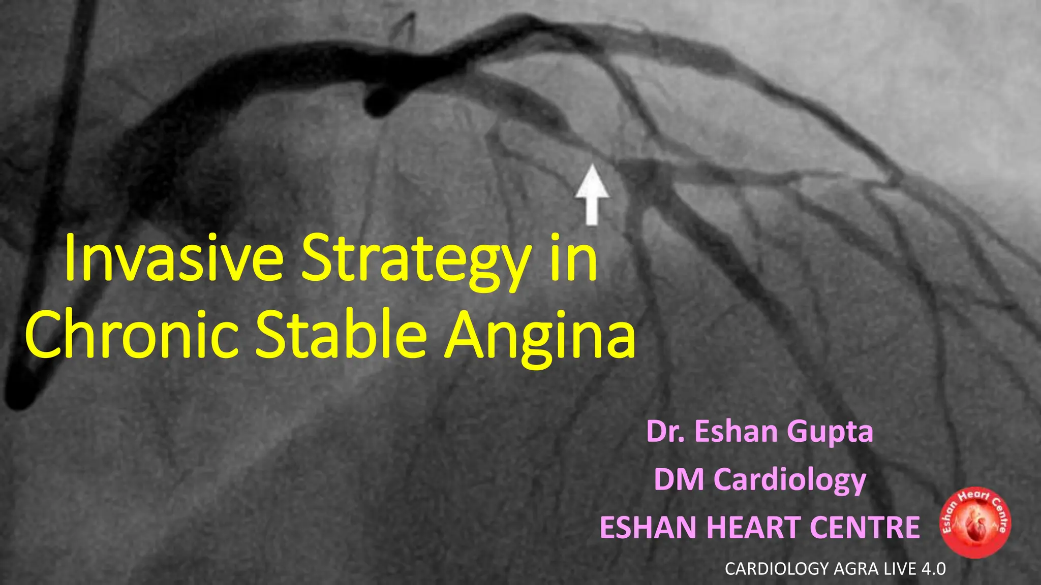 Angioplasty vs medical management in CAD(ANGINA) .pptx