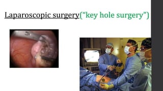 appendicitis | PPTX | Digestive Disorders | Diseases and Conditions