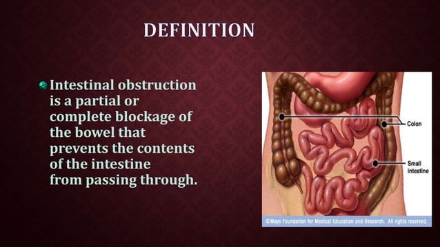 intestinal obstruction | PPTX | Digestive Disorders | Diseases and ...