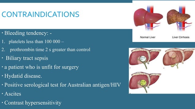 Ptc )percutaneous transhepatic cholangiography | PPTX | Digestive ...