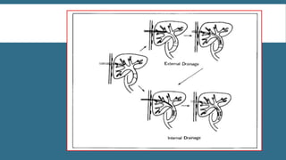 Ptc )percutaneous transhepatic cholangiography | PPTX