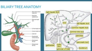 Ptc )percutaneous transhepatic cholangiography | PPTX