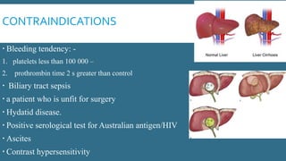 Percutaneous Transhepatic Cholangiography