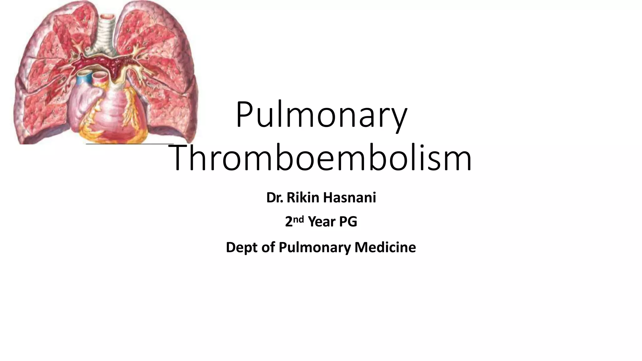 Pulmonary Thromboembolism Diagnosis and Treatment | PPT