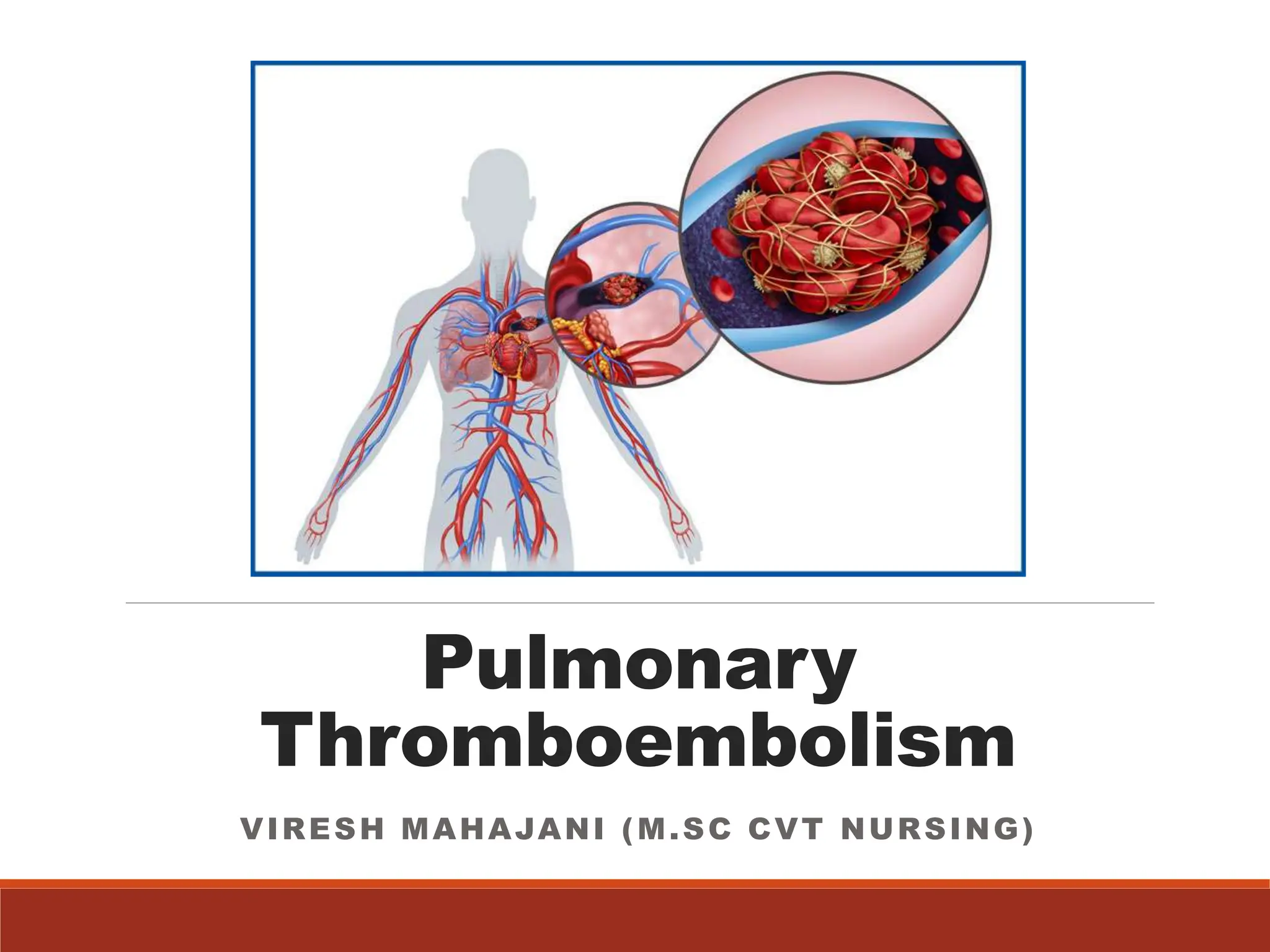 Pulmonary Thromboembolism - etilogy, types, medical- Surgical and ...