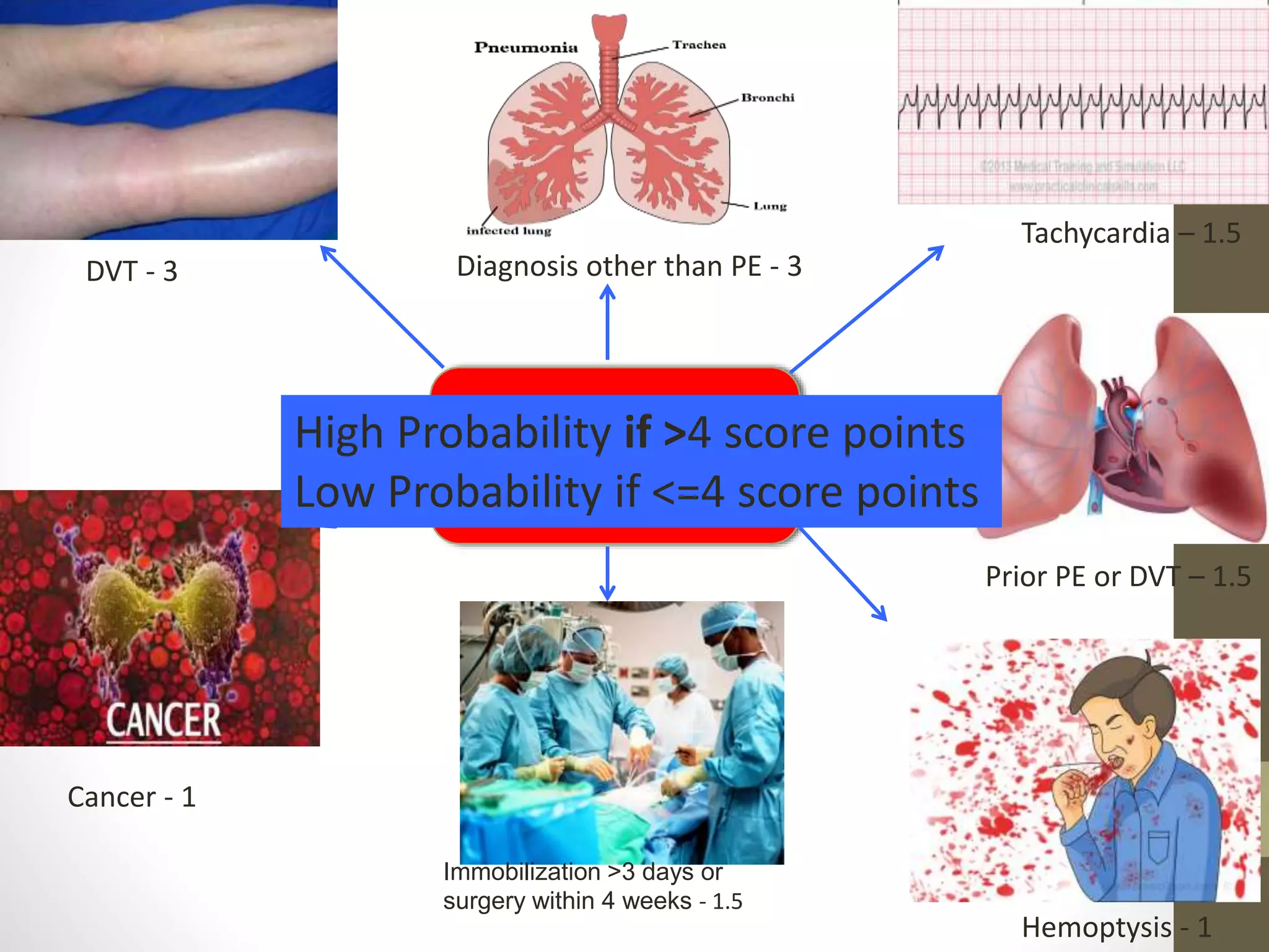 Management of Venous Thromboembolism | PPTX