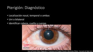 Pterigión | PPTX
