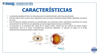 PTERIGION ANATOMIA, TECNICA QX.pptx