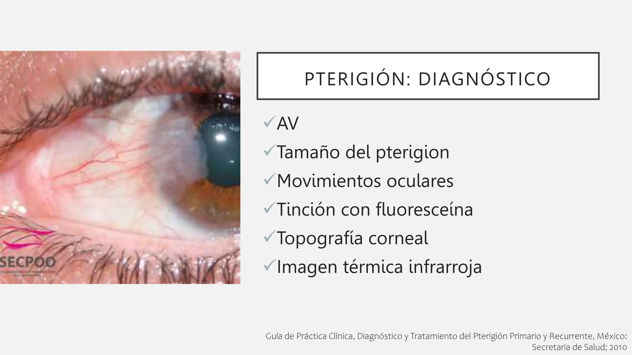 PTERIGION OFTALMOLOGIA,PTERIGION OFTALMOLOGIA,PTERIGION OFTALMOLOGIA, .pptx