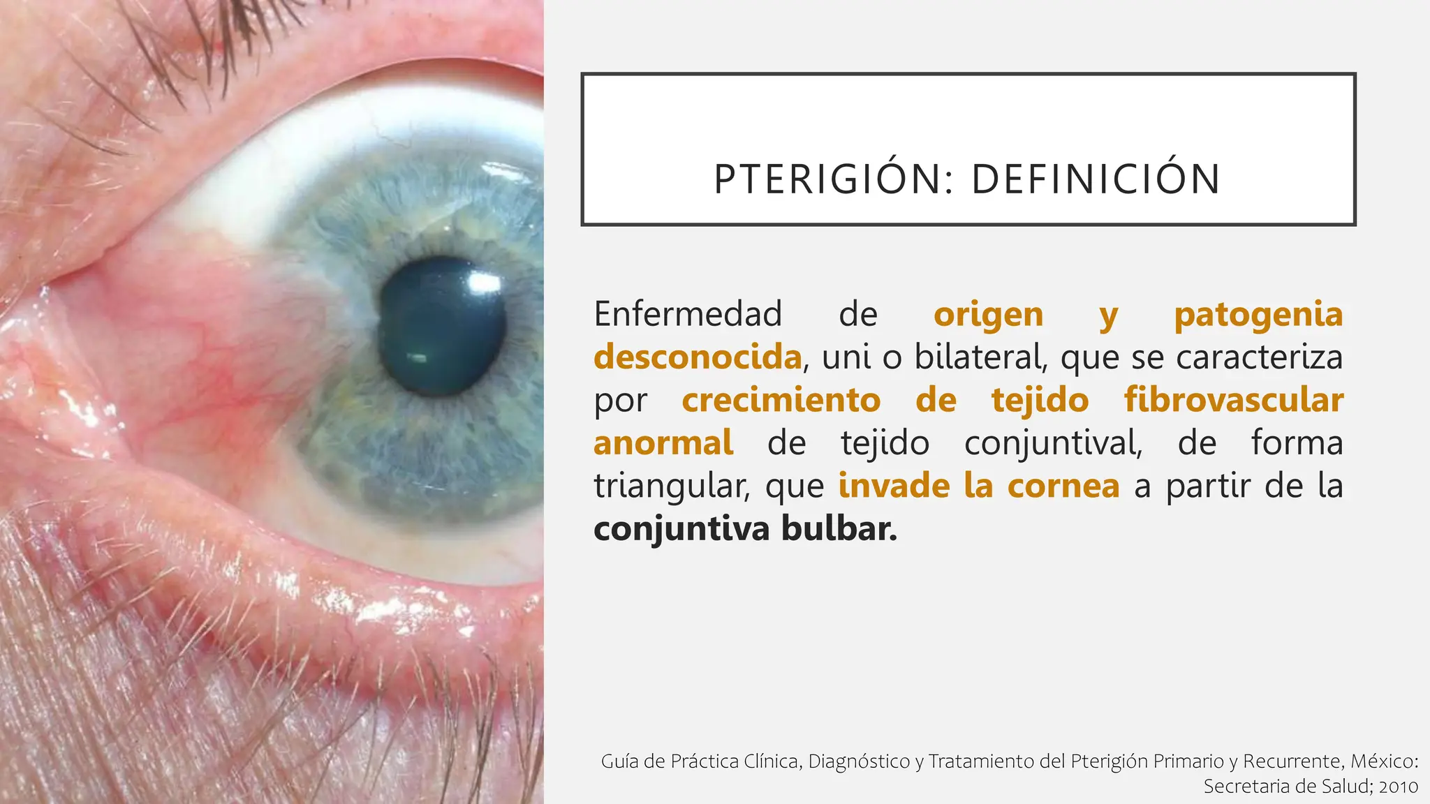 PTERIGION OFTALMOLOGIA,PTERIGION OFTALMOLOGIA,PTERIGION OFTALMOLOGIA, .pptx