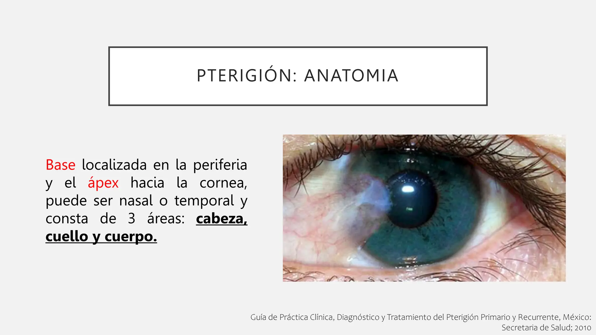 PTERIGION OFTALMOLOGIA,PTERIGION OFTALMOLOGIA,PTERIGION OFTALMOLOGIA, .pptx