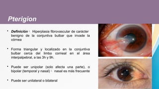 pterigion clasificacion tratamietno y manejo | PPTX