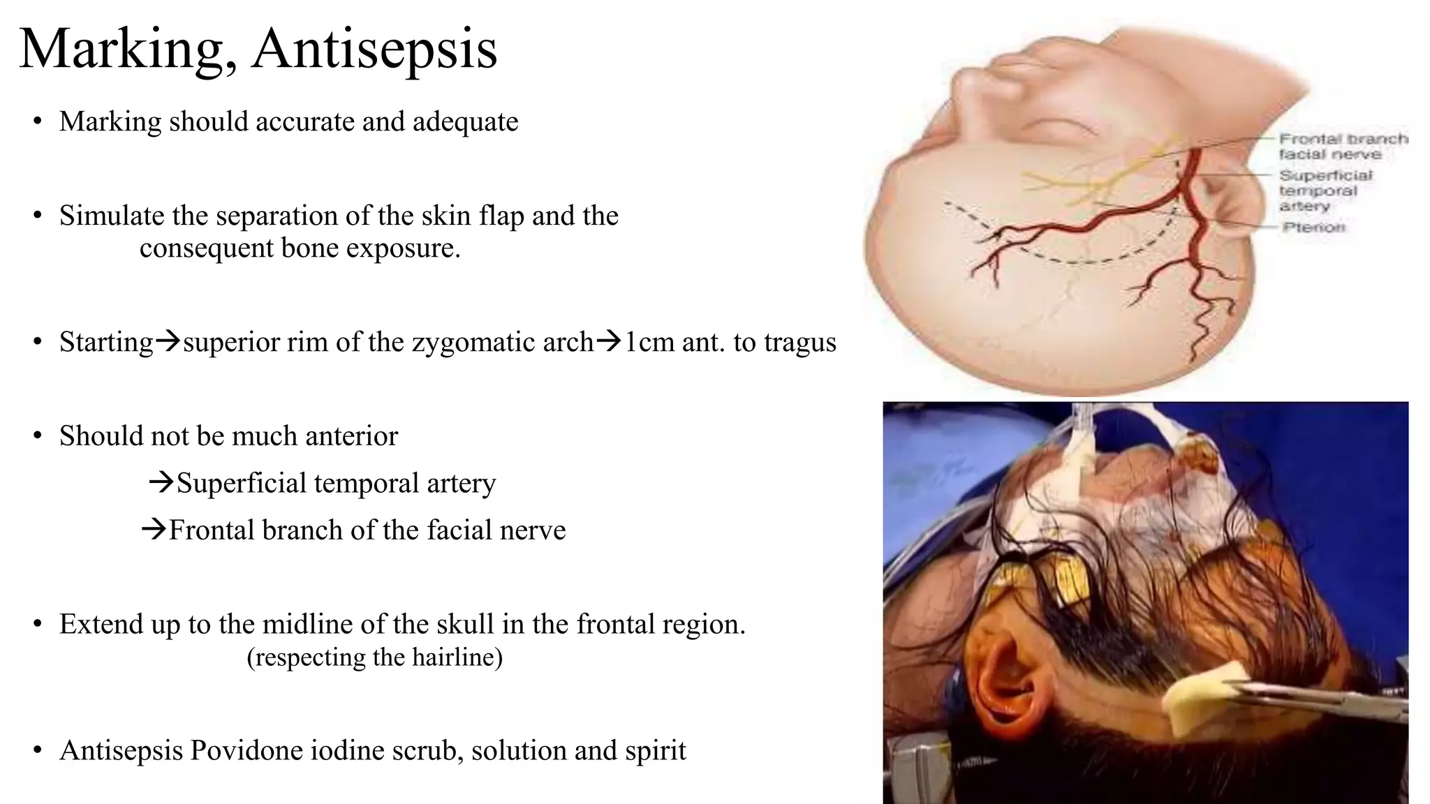 Pterional craniotomy | PPTX