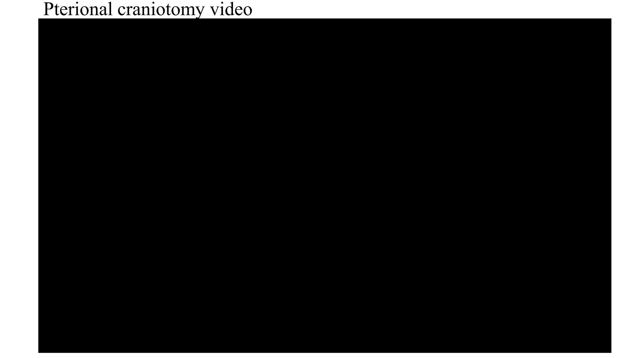 Pterional craniotomy | PPTX