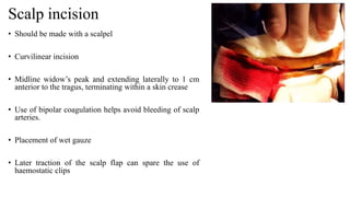 Pterional craniotomy | PPTX