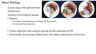 Pterional craniotomy | PPTX