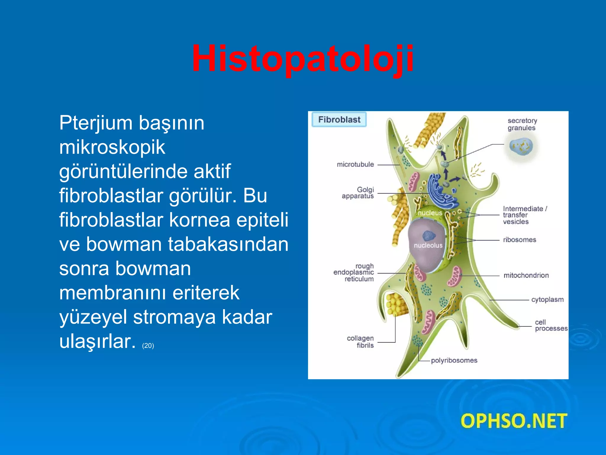 Pterjium anatomi-klinik | PPT