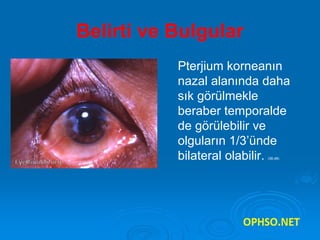 Pterjium anatomi-klinik | PPT