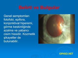 Pterjium anatomi-klinik | PPT