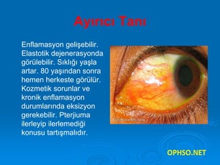 Pterjium anatomi-klinik | PPT
