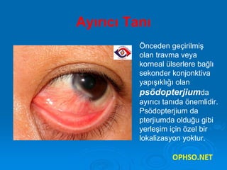 Pterjium anatomi-klinik | PPT
