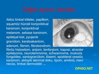 Pterjium anatomi-klinik | PPT