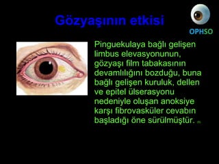 Pterjium patogenez | PPT