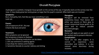Pterygium | PPTX