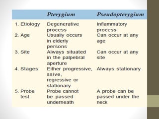 Pterygium | PPTX