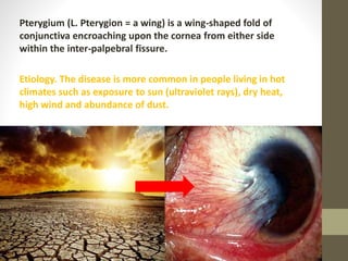 Pterygium | PPTX