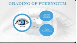 pterygium आर्म.pdf.pptx