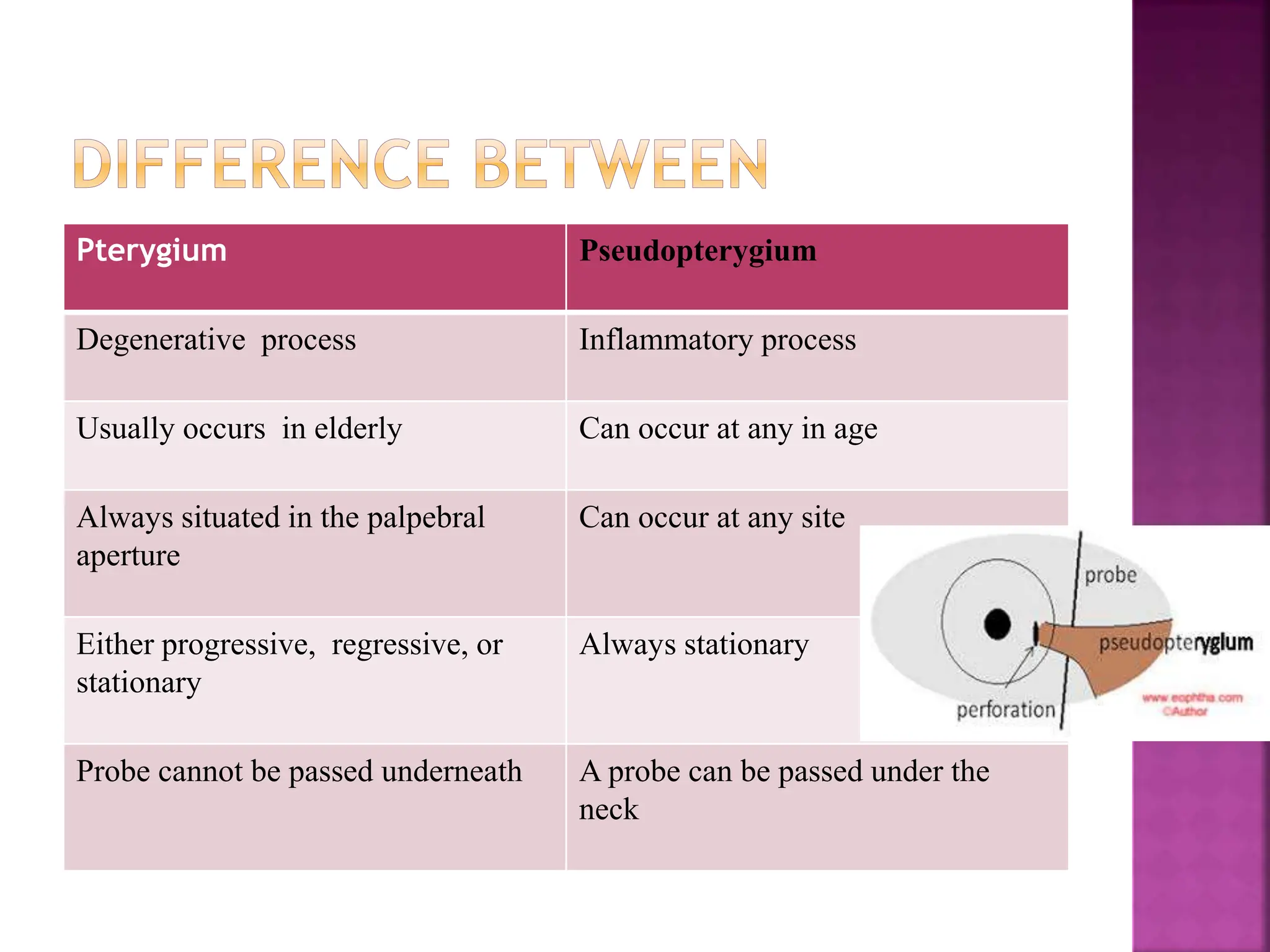 PTERYGIUM ,clinical picture and its management.pptx