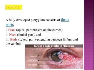 PTERYGIUM ,clinical picture and its management.pptx