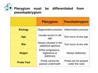 Pterygium (practical slides) | PPTX