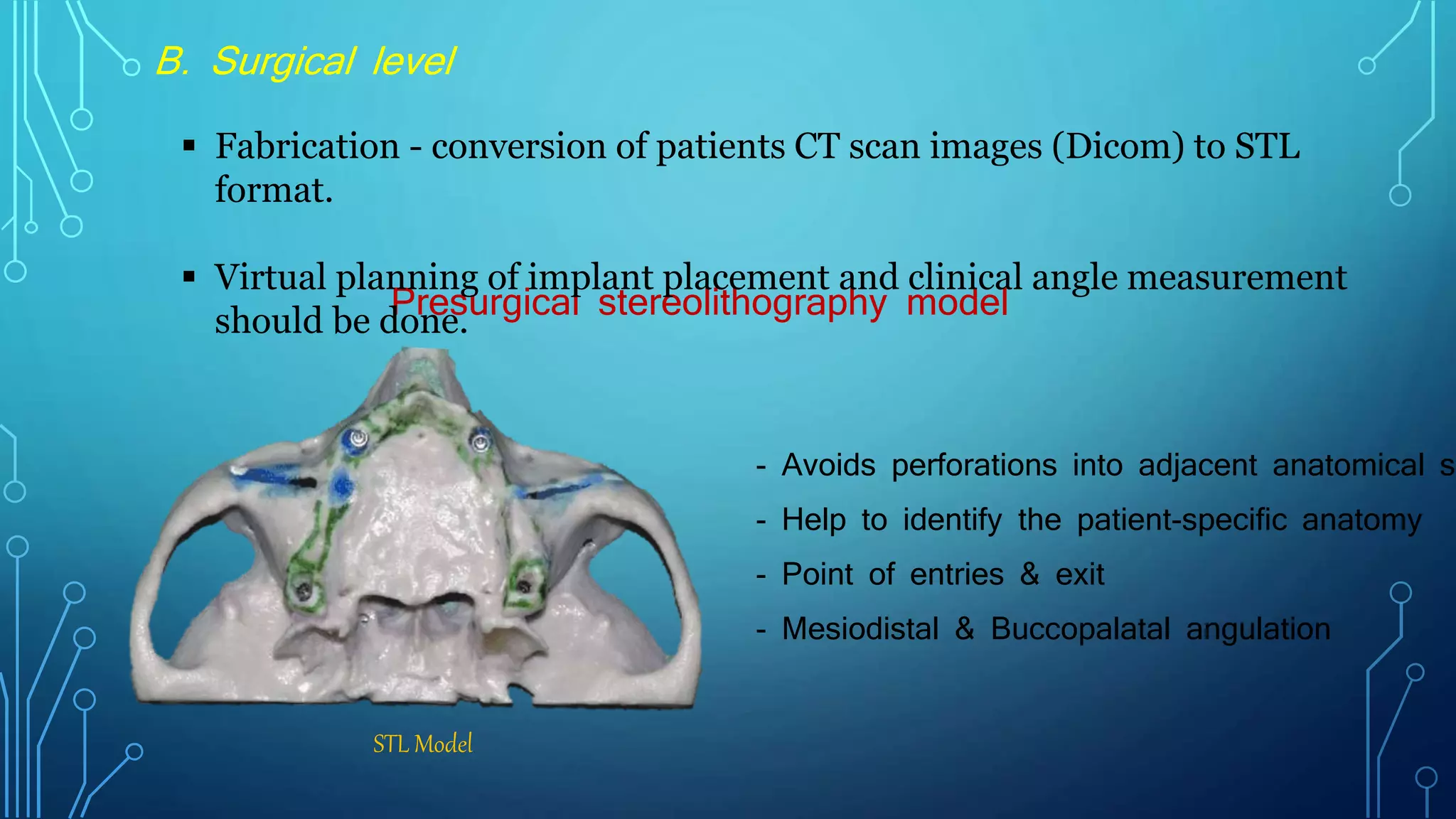 Pterygoid Implants | PPTX