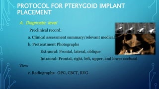 Pterygoid Implants | PPTX
